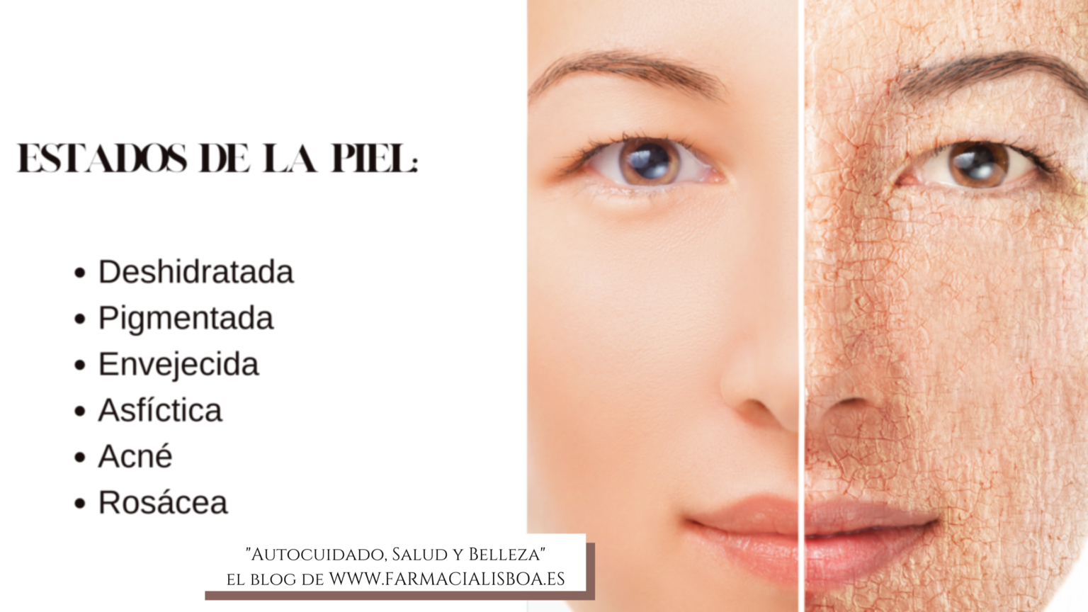 ¿Conoces la diferencia entre tipo y estado de piel? - Blog de Farmacia ...
